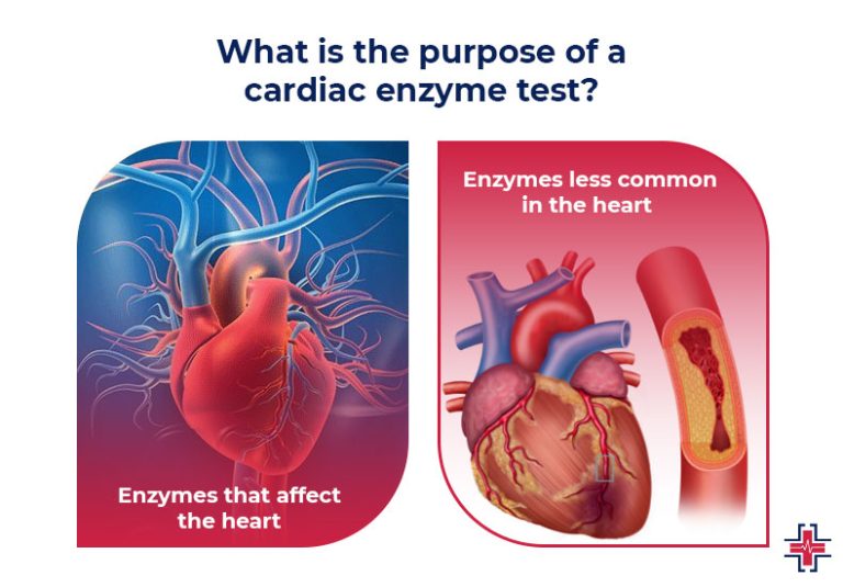 Understanding Cardiac Enzyme Test: Purpose And Normal Ranges | ER of ...