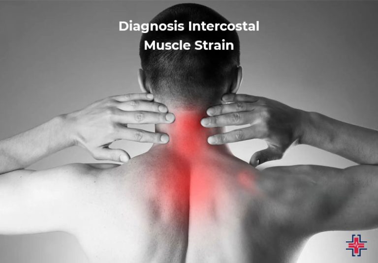 Intercostal Muscle Strain: Signs, Treatments Diagnosed, and Remedies ...